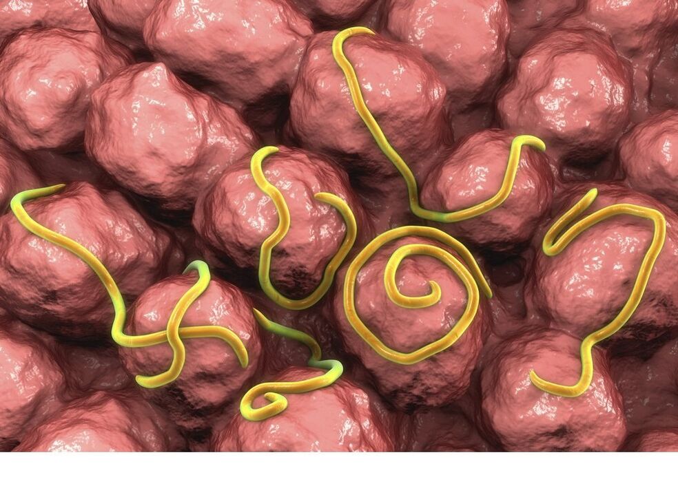 Helminti: simptomi, diagnoza in zdravljenje